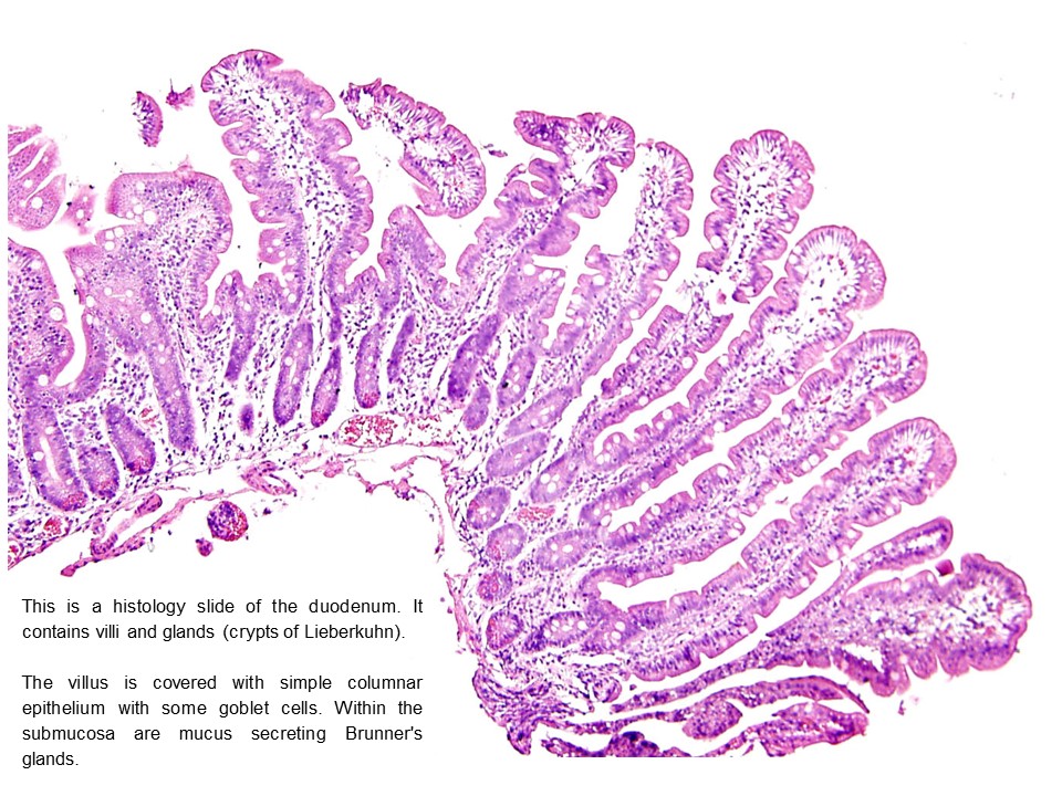 A Histology Tour of the GI Tract- The Duodenum