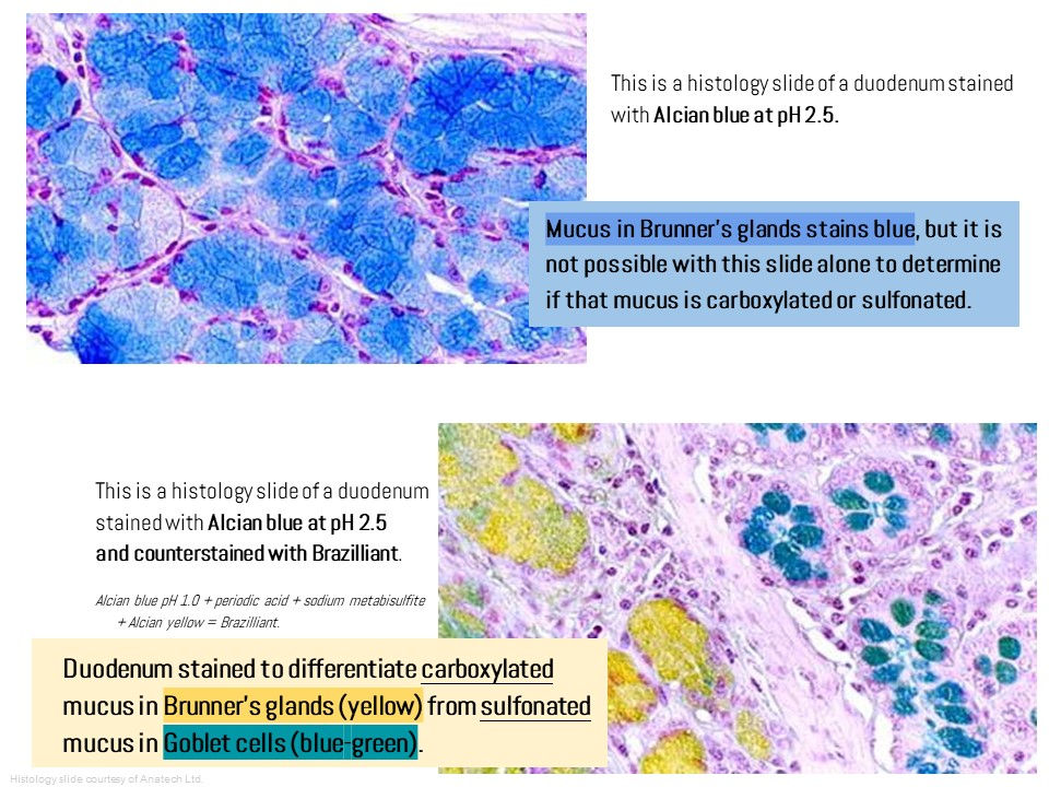A Histology Tour of the GI Tract- The Duodenum