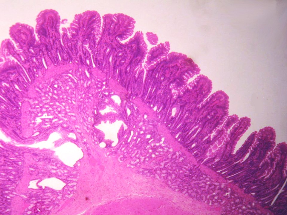 A Histology Tour of the GI Tract- The Duodenum