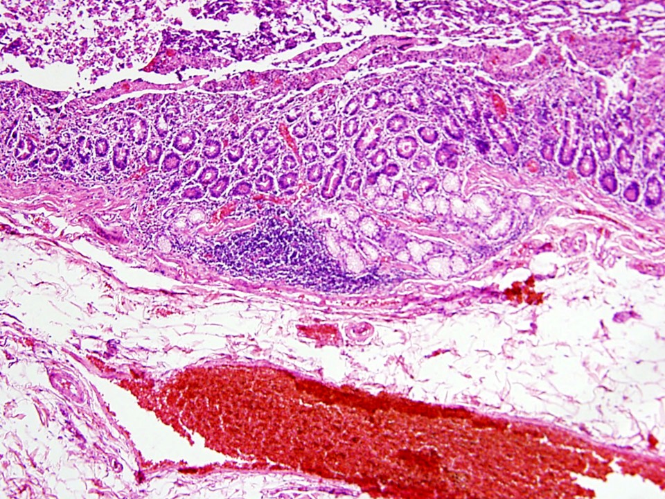 A Histology Tour of the GI Tract- The Duodenum