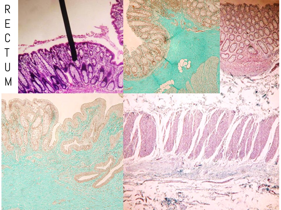 A Histology Tour of the GI Tract- The Colon, Rectum and Anus