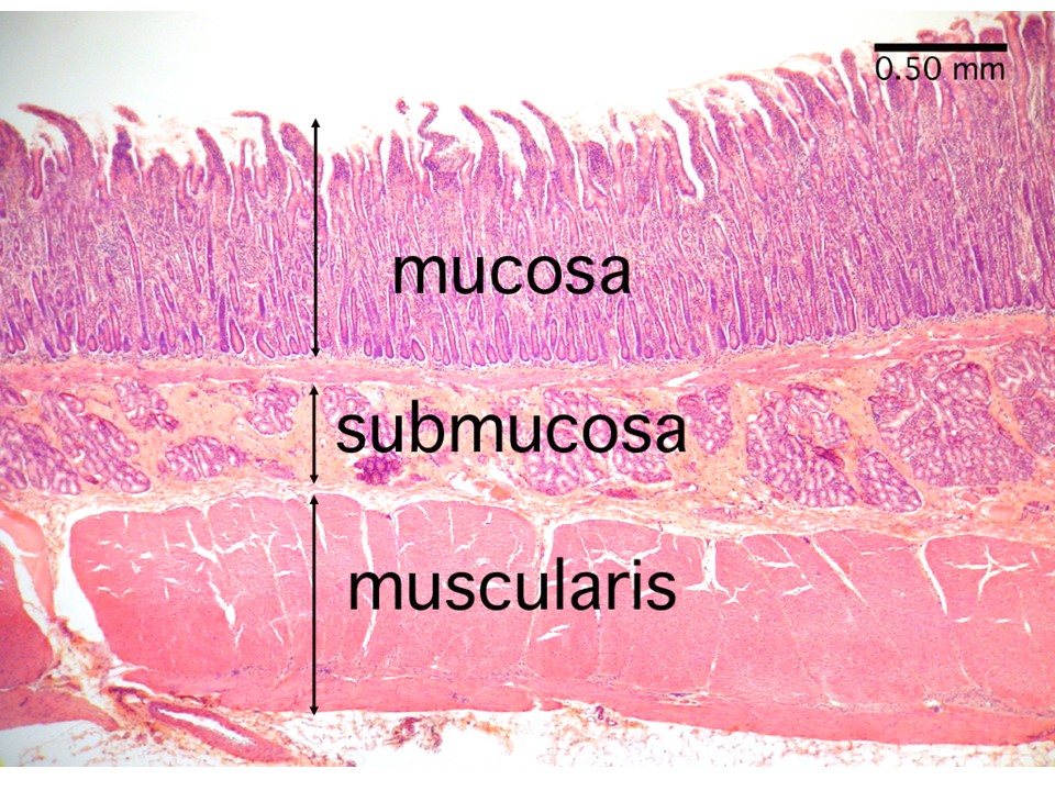 A Histology Tour of the GI Tract- The Duodenum