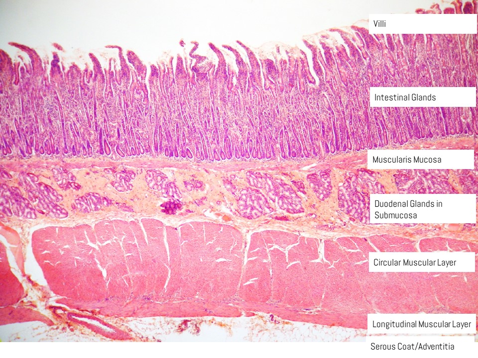 A Histology Tour of the GI Tract- The Duodenum