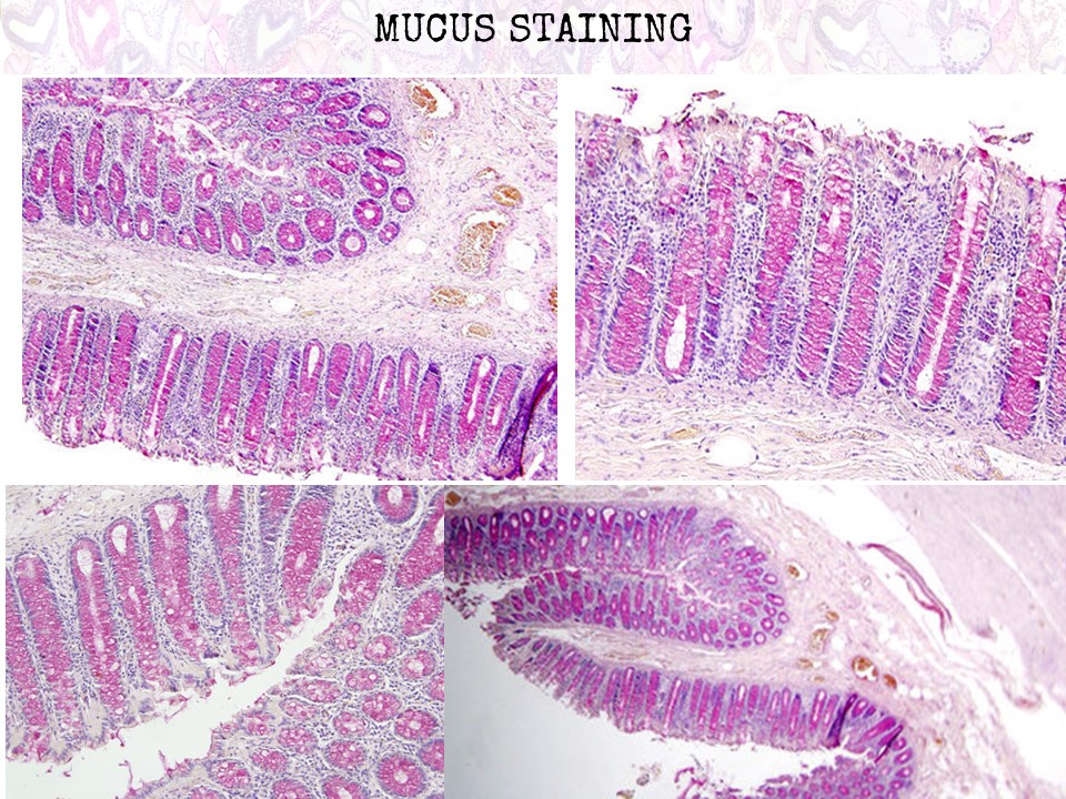 A Histology Tour of the GI Tract- The Colon, Rectum and Anus
