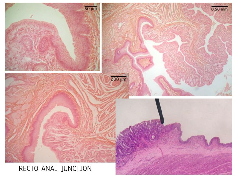 A Histology Tour of the GI Tract- The Colon, Rectum and Anus