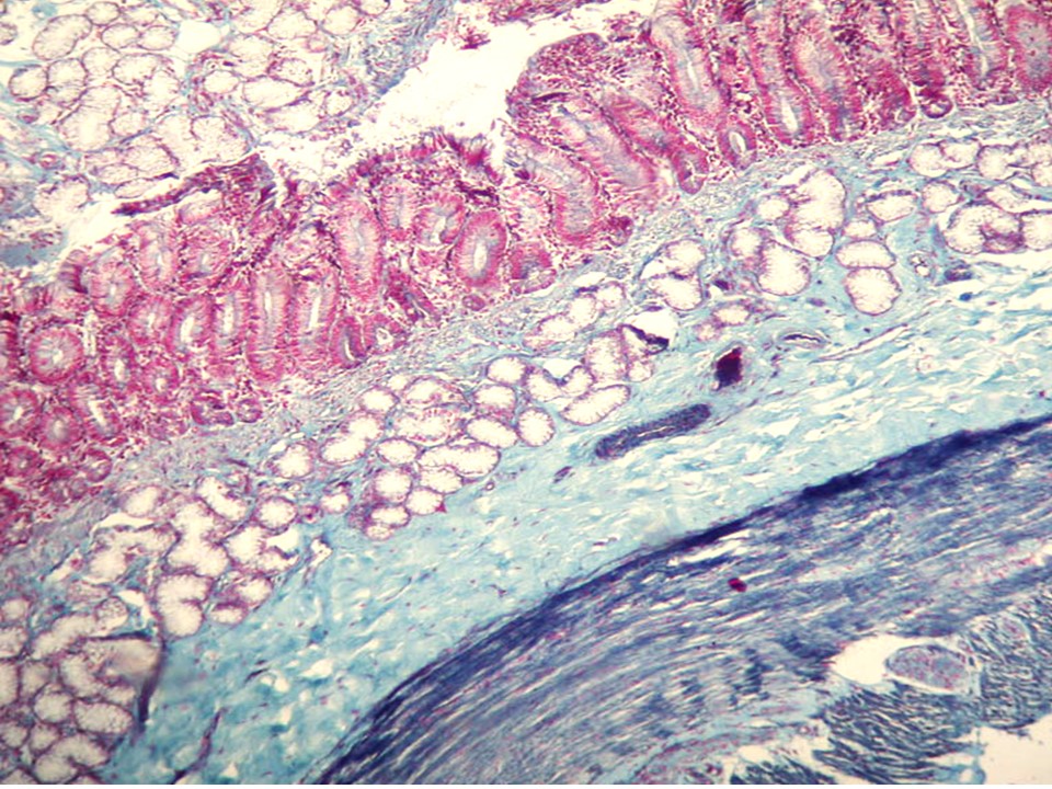A Histology Tour of the GI Tract- The Duodenum