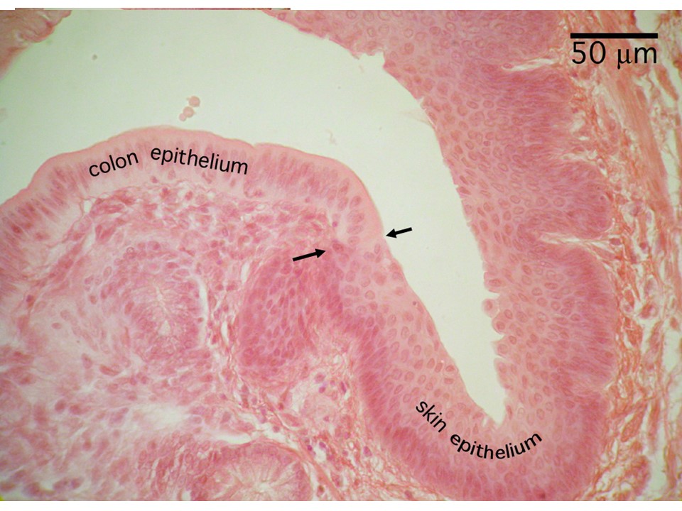 A Histology Tour of the GI Tract- The Colon, Rectum and Anus