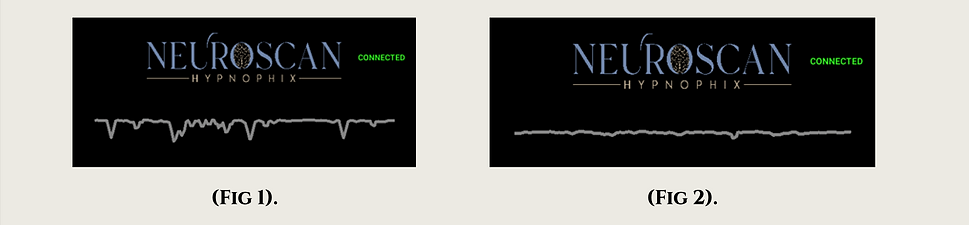 NEUROSCAN | Hypnophix