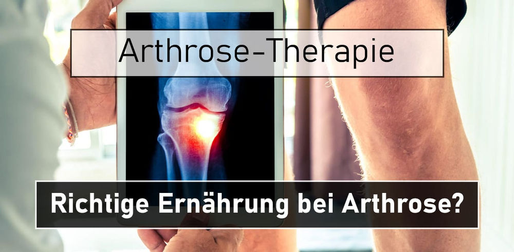 Arthrose-Therapie: Wunderwaffe gegen Arthrose?