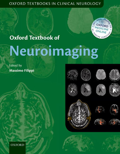 Oxford Textbook of Neuroimaging (Oxford Textbooks in Clinical Neurology ...
