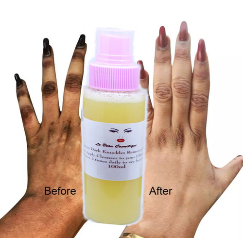 Dark Knuckle Remover Cream /Exfoliating Scrub / Knuckle Cleanser ...