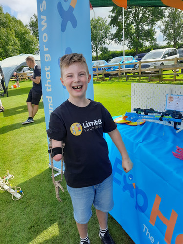 The ExpHand: Premium Colours | ExpHand Prosthetics