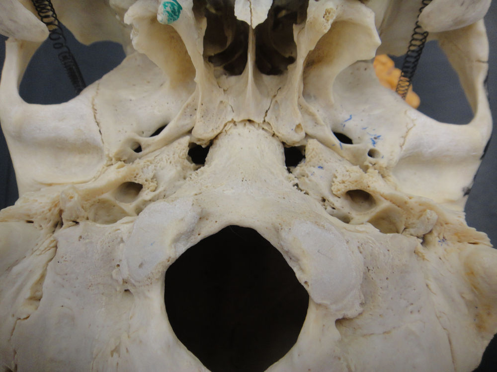Foramina in Norma Basalis of skull | Dr.B.B.Gosai