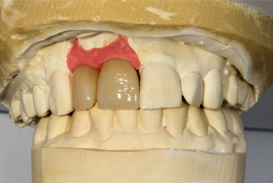 Northshore Dental Labs | Home