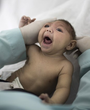 Exame Neurológico | Roteiros Pediatria
