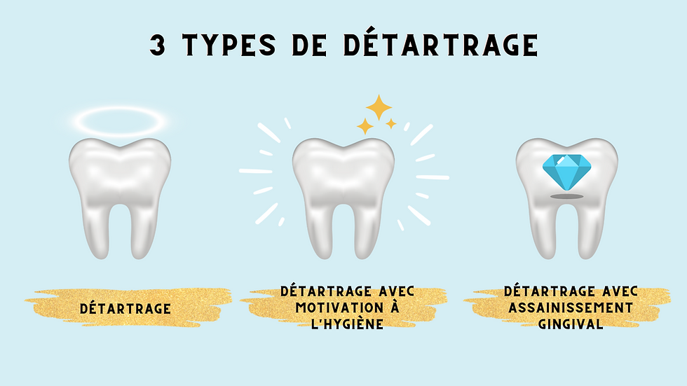 Le détartrage : pratique clé pour une hygiène dentaire optimale
