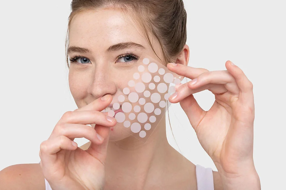 Pimple Patches: The Life Saviour of Acne-Prone Skins