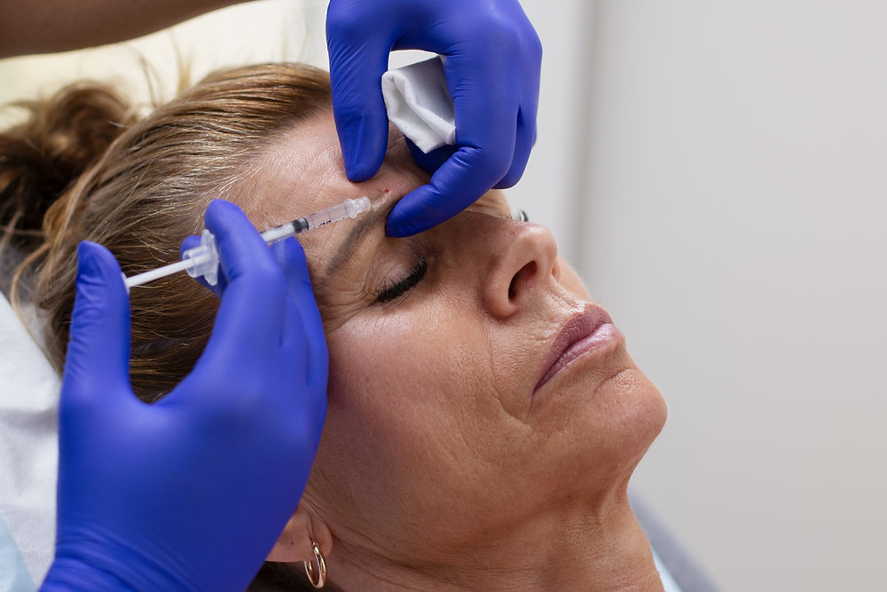 Understanding the Basics of Botox: A Comprehensive Guide for Beginners