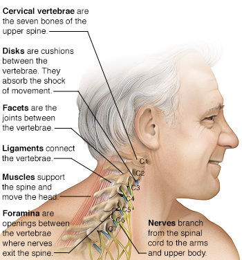 6 Main Types of Neck Pain | Saltash Chiropractic Clinic | Saltash