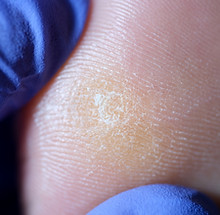 Patient Education | Advanced Foot & Orthotic Clinic