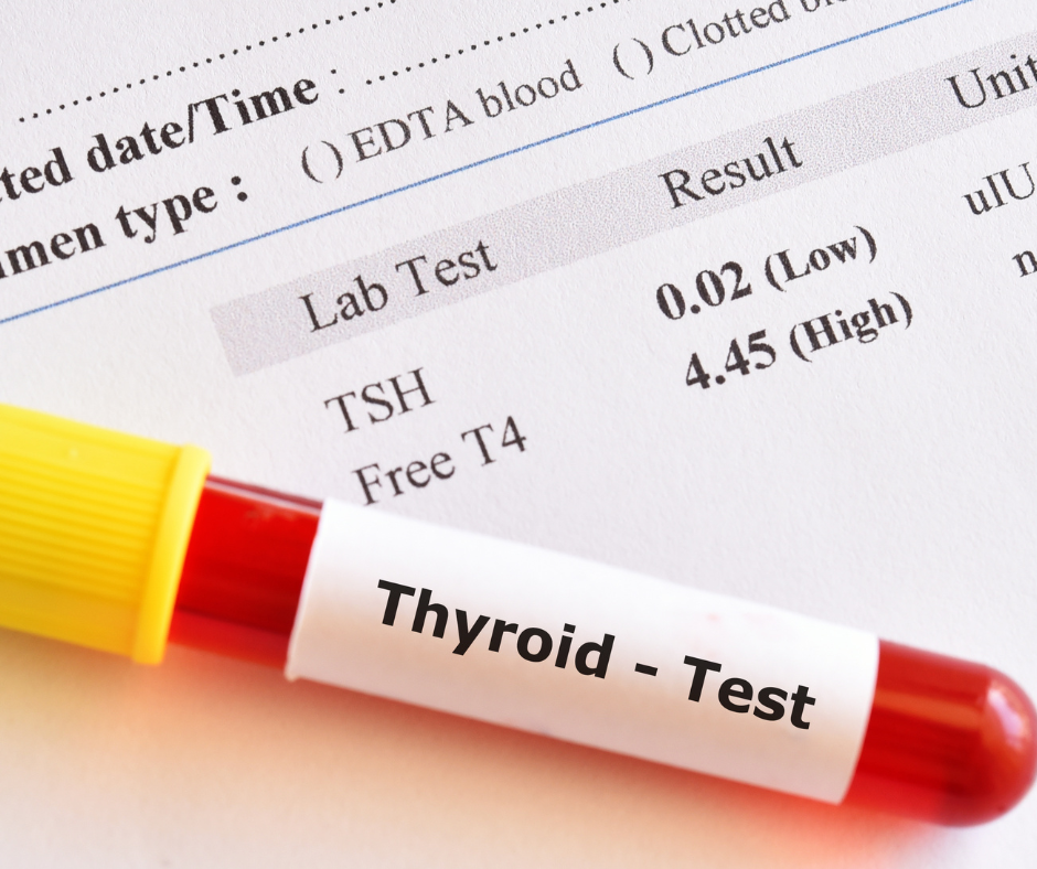 Within reference range vs optimal blood test results. What you need to ...