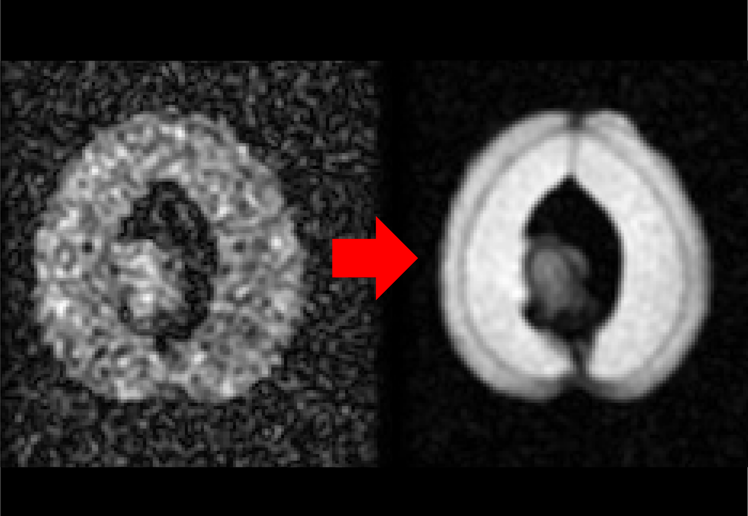 Selecting Imaging Parameters for RARE Pulse Sequences