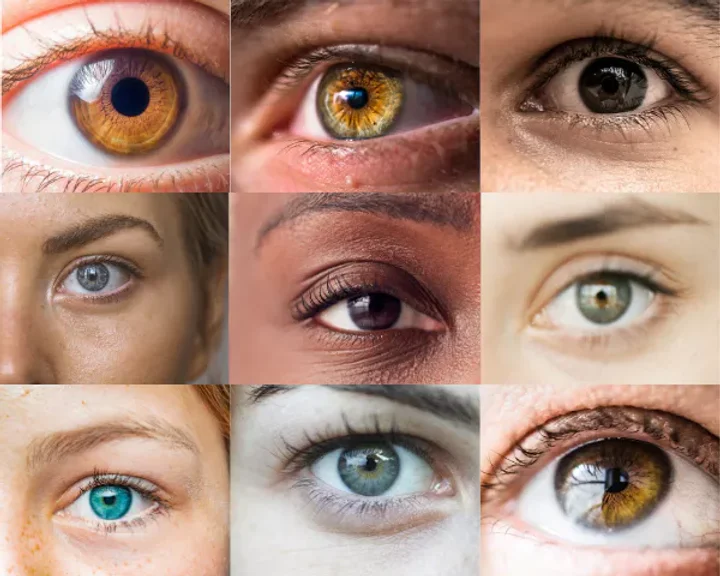 Eye color and Coronary artery disease risk