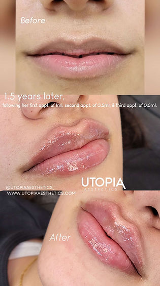 LIPS GALLERY | Utopia Aesthetics