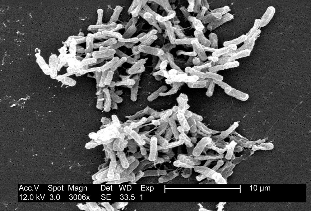The Latest Poop on Fecal Microbiota Transplantation