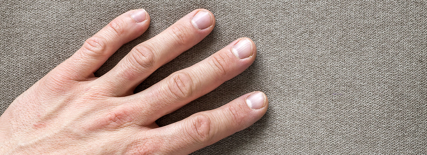 Common Nail Conditions That May Require Treatment