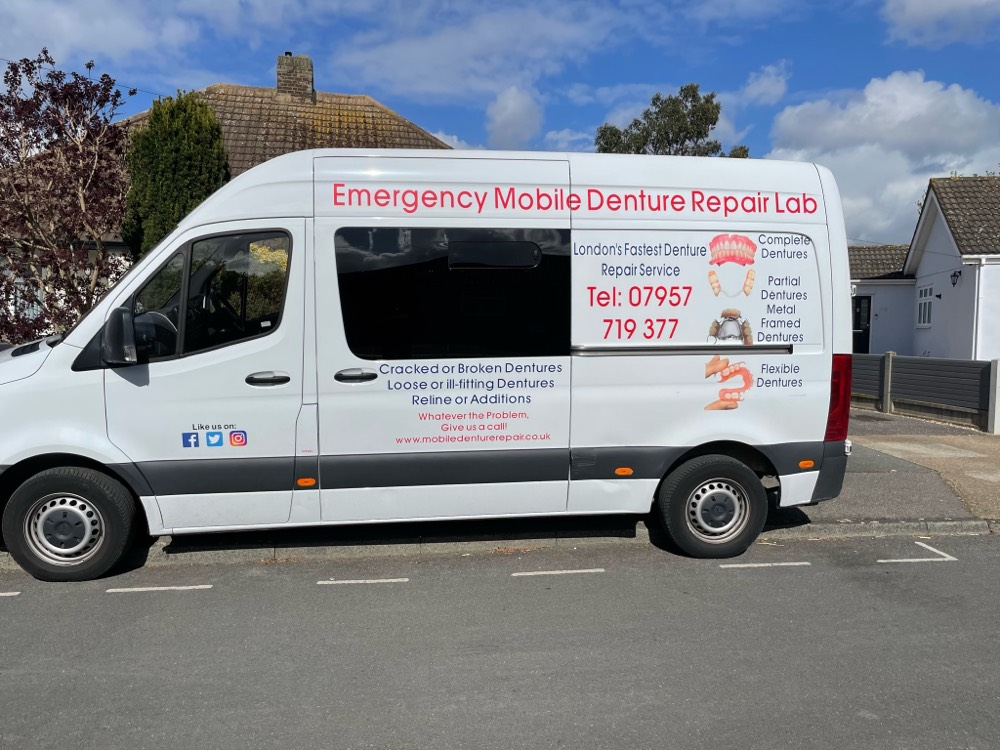 Mobile dental lab | Mobile Denture Repair | London