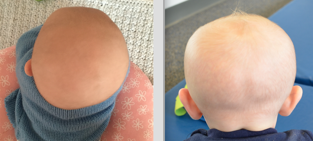 Big Leaps-Pediatric Physical & Occupational Therapy - Gallery