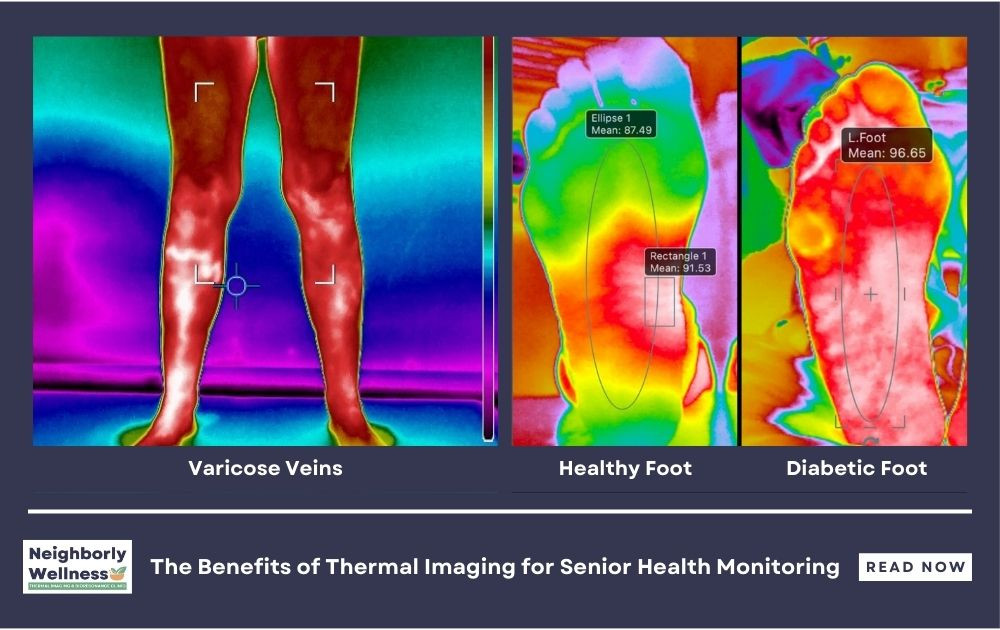 The Benefits of Thermal Imaging for Senior Health Monitoring