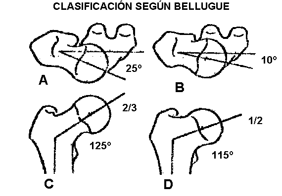 Teoria