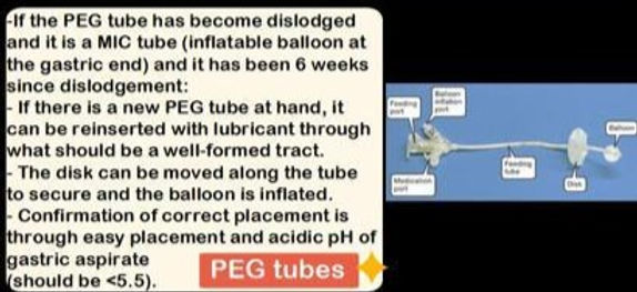 PEG TUBES