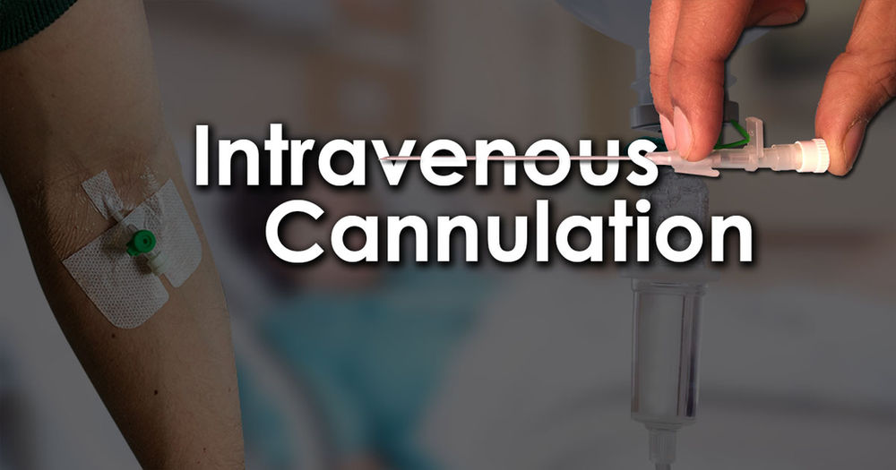 IntraVenous Cannulation