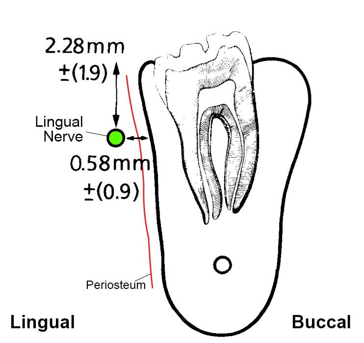 Vital Structures around Mandibular Third molar