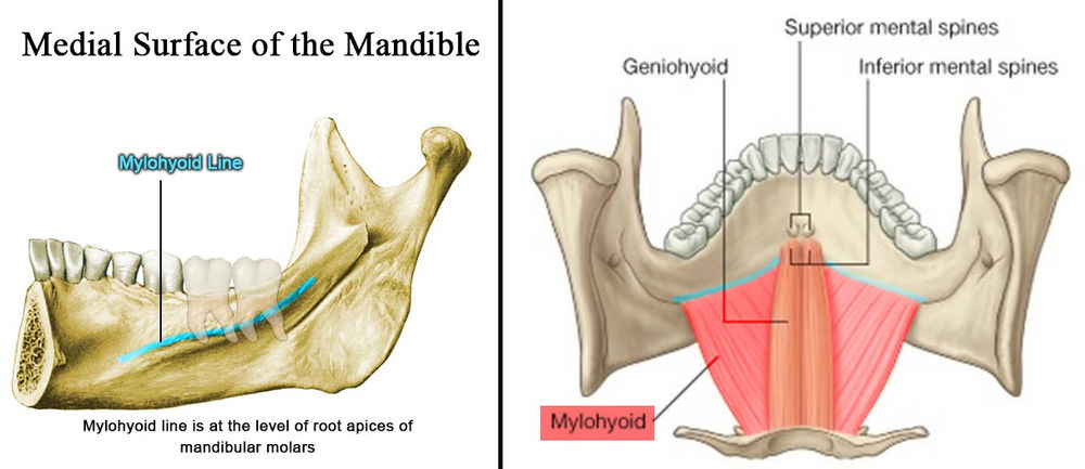 Head & Neck Space Infection