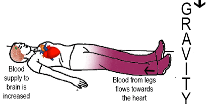 Syncope. Good or Bad?