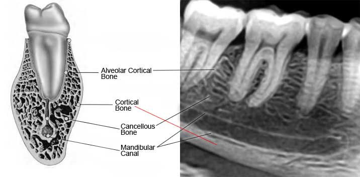 Maxillary Sinus & Molar Roots Relationship