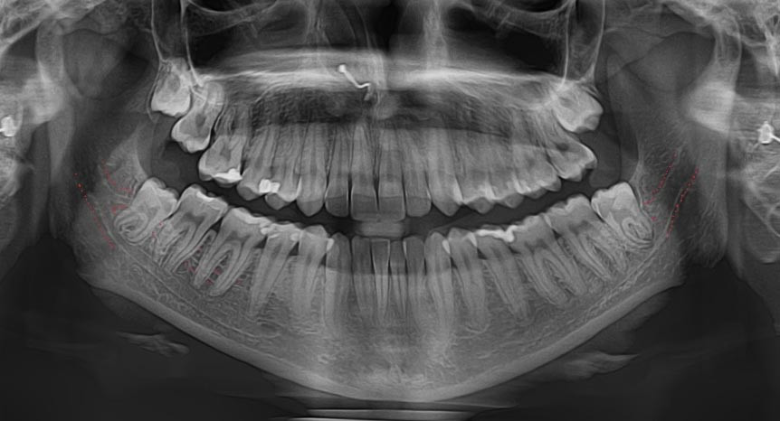 2 things I wish I knew 8 years ago while administering Inferior ...