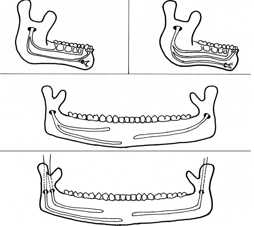 2 things I wish I knew 8 years ago while administering Inferior ...