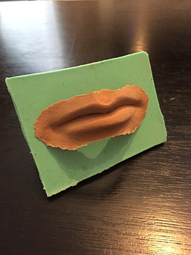 Prosthetic Lips | PMRC