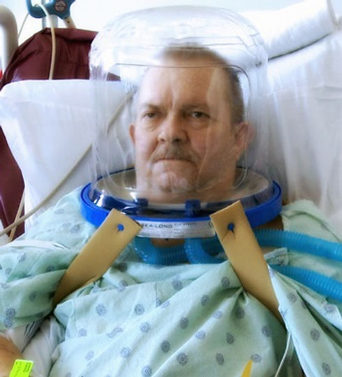 How Helmet Ventilation Helps Patients | Helmet NIV