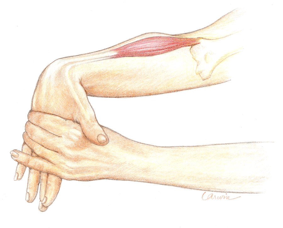 ‘TENNIS ELBOW’ - 5 TIPS FOR RELIEVING THAT OUTER ELBOW PAIN, ALSO KNOWN ...