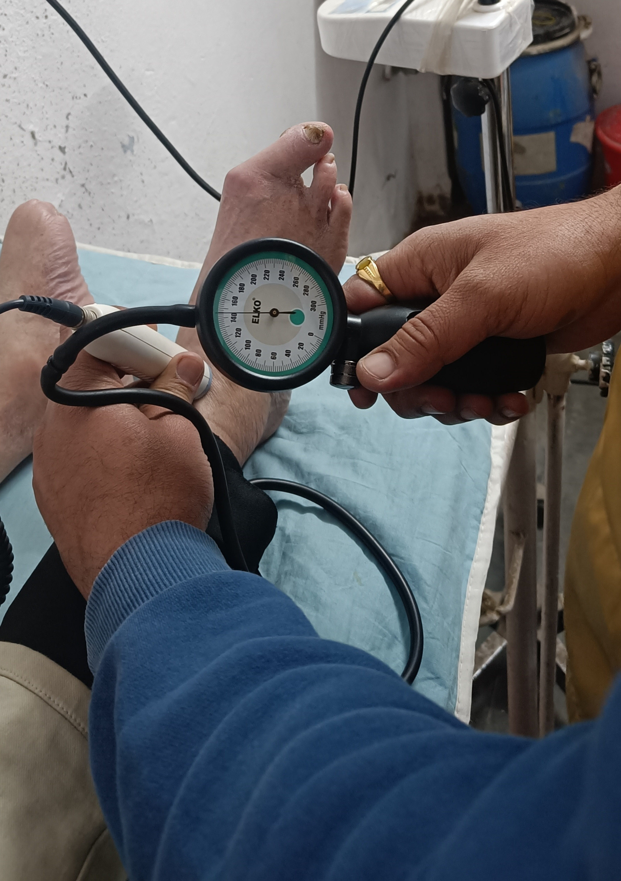 How to Assess for PVD with Claudications and Ankle Brachial Index: A ...