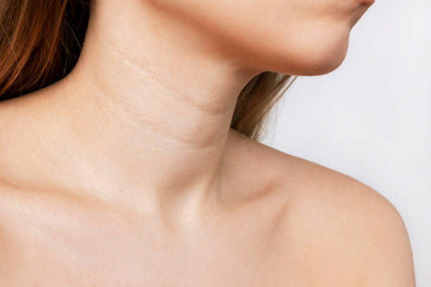 Horizontal Neck Lines: Types, Causes, and Advanced Treatments