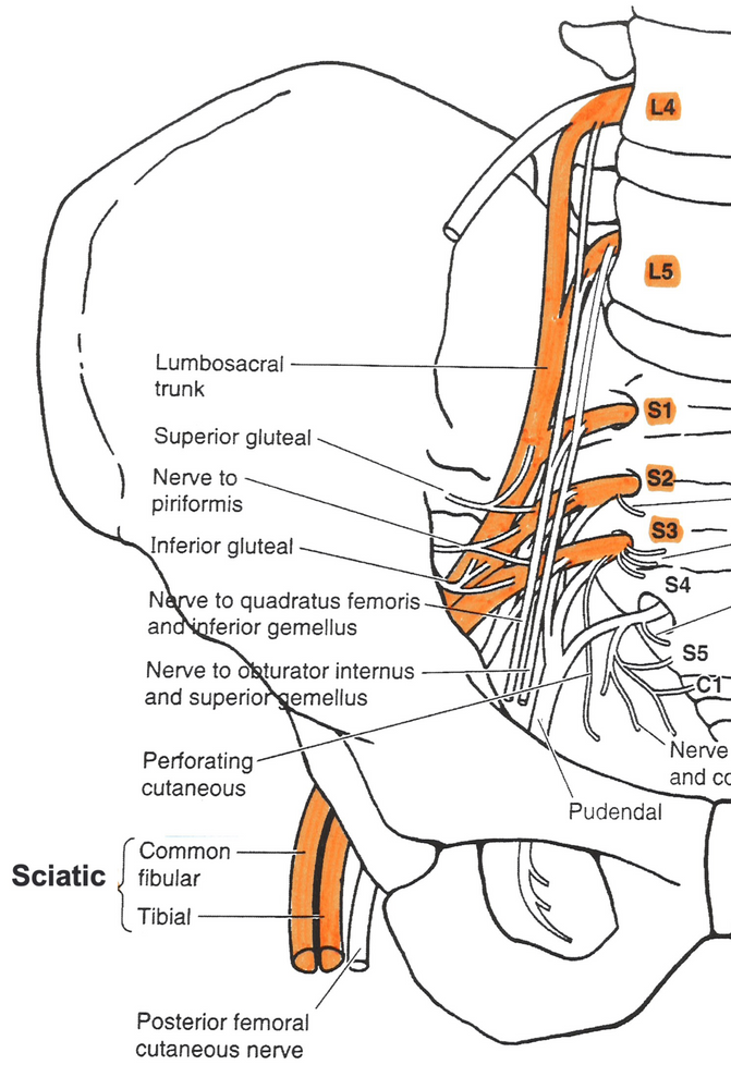 What is Sciatica?