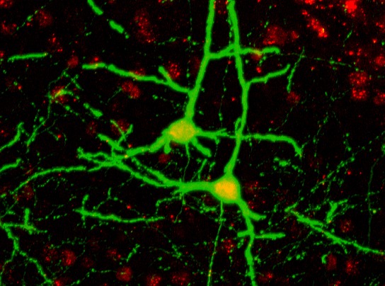 Neural Development | Tran Lab - Neuronal Wiring | United States