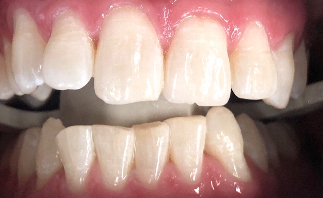 Before / Afters | Smile Transformation Gallery | Dr Whyte Smile